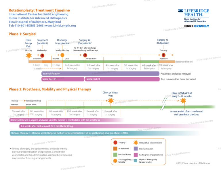 Rotationplasty | International Center for Limb Lengthening